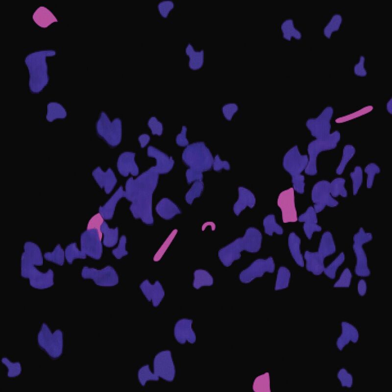 SORTEX N | Nut sorting machine | Bühler Group